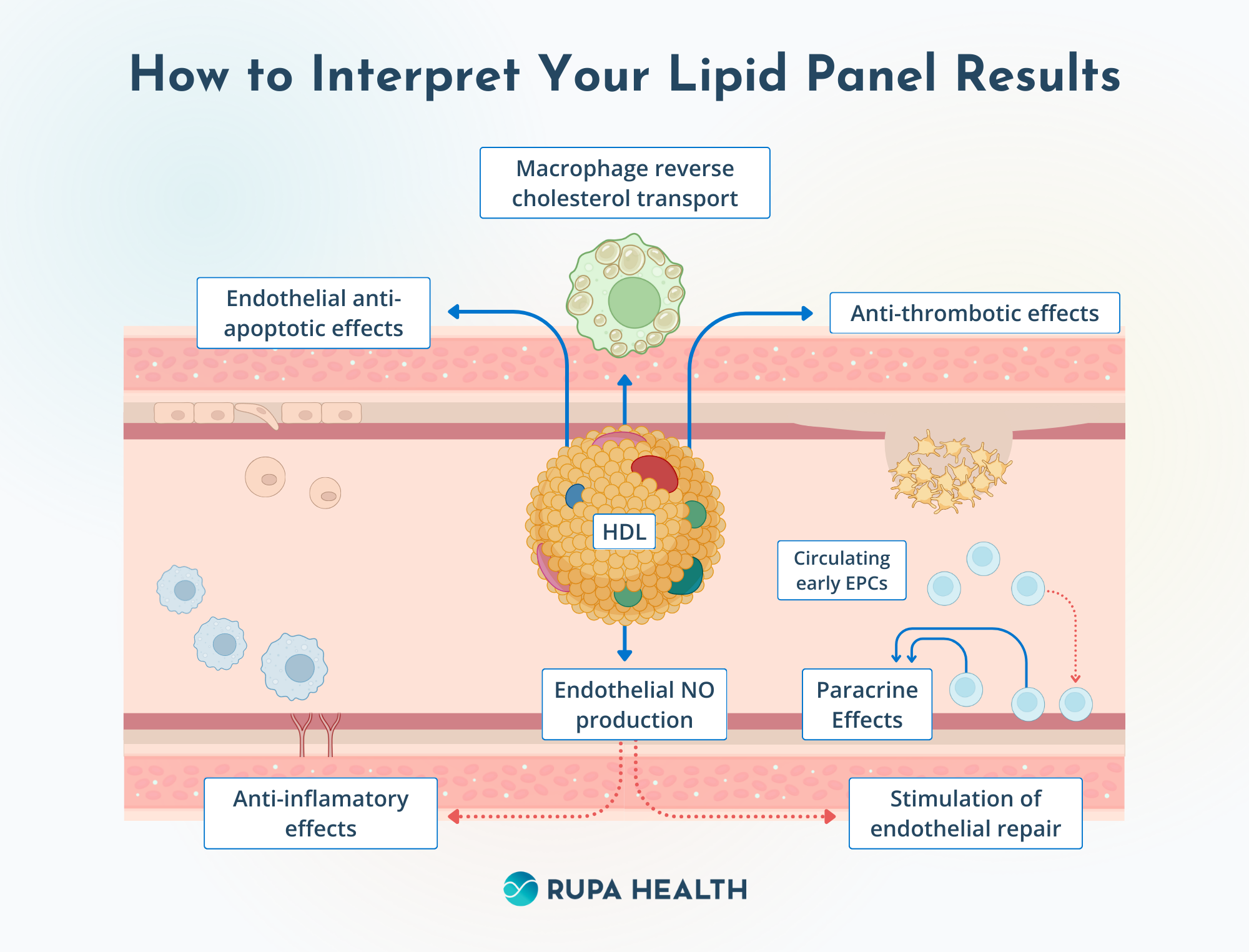 How To Interpret Your Lipid Panel Results